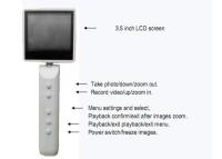 China Video Ear And Nose C amera Digital Otoscope For Perforation Of The Tympanic Membrane for sale