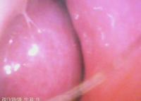 China ENT Endoscopy Camera ENT Video Rhinoscope Laryngoscope Examination Unit for sale