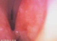 China Video ENT Endoscope Photos Nose Throat Inspection Video Camera With Flexible lens for sale