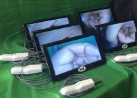 China Portable Self-Colposcope For Gynecology Connected To Monitor Computer Television for sale