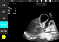 China Cardiac Handheld Ultrasound Machine Wireless Ultrasound Probe Human Or Vet Usage Available for sale