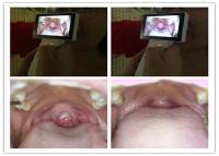 China Digital Video Otoscope Full Digital Inspection With SD Card Output USB Otoscope for sale