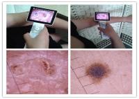 China Digital Video Otoscope Full Digital Inspection With SD Card Output USB Otoscope for sale