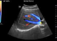 China 15 Inches Color Doppler Ultrasound Scanner Machine High Resolution LCD Screen for sale