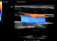 China Pocket Wireless Hand Ultrasound Machine Android Windows IOS System Available for sale