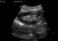 China Pocket Wireless Hand Ultrasound Machine Android Windows IOS System Available for sale