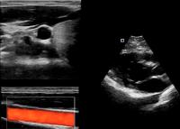 China Color Doppler Ultrasound Probe Handheld Ultrasound Device For Mobilephone / PC for sale