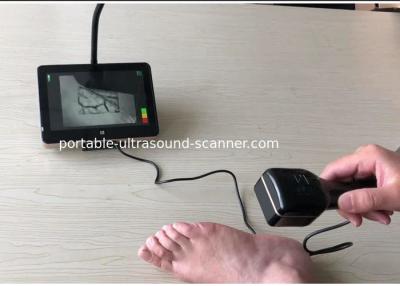 China Medical Vein Viewing System Infrared Vein Locator Handheld Pocket Vein Viewer with LED Light for sale