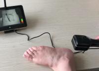China Portable Economical Infrared Vein Finder Vascular Detector With Near Vein Light for sale