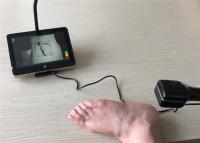 China Clinic Portable Infrared Vein Locator Device No Radiation No Laser Vein Imaging Device for sale