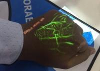 China Mini Vein Locator Device Display A Map Of Vasculature On The Surface Of The Skin In Real Time for sale