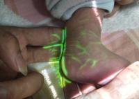China Vein Showing System Handheld Infrared Vein Finder Locator Transilluminator Vein Viewer For Children for sale