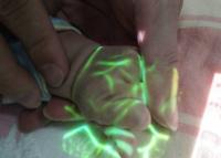 China Near Infrared Light Medical Vein Veiwer Portable Vein Finder For Children Infant for sale