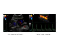 China 2 Probe Connectors Laptop Ultrasound Scanner Color Doppler Machine With High Resolution for sale
