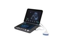 China Digital Portable Mobile Laptop Ultrasound Scanner With 12-inch LED Display & 9.7-inch Touch Screen for sale