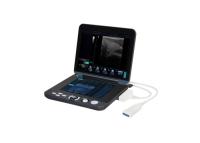 China 9.7 Inch Touch Screen Control Panel Battery Veterinary Portable Ultrasound USB Diagonosis Pregnant Ultrasound for sale