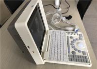 China Portable Pregnancy Ultrasound Scanner Intelligent Zoom 12 