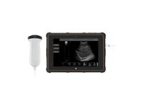 China Portable Ultrasound Unit Portable Ultrasound Scanner 4 Types of Probes Available with Frequency 2~15MHz for sale