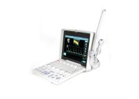 China 1024 Frame Laptop Color Doppler Device Portable Ultrasound Scanner With 2 Probe Connector for sale