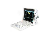 China Full Digital Portable Color Ultrasound Scanner Economical Color Ultrasound Doppler With PW Function for sale