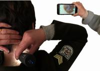 China WIFI Skin Analyer Digital Video Dermatoscope Skin Watcher With 2 Million Pixels for sale