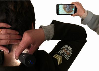 China WIFI Skin Analyer Digital Video Dermatoscope Skin Watcher With 2 Million Pixels for sale