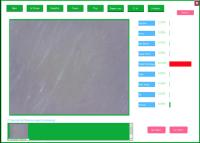 China Professional Video Dermatoscope Analysis System With Analysis And Testing Report for sale