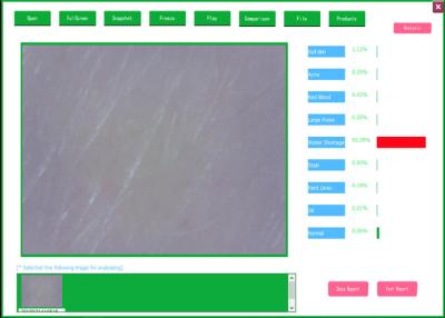 China Professional Video Dermatoscope Analysis System With Analysis And Testing Report for sale