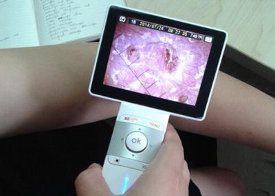 China Handheld Skin And Hair Analysis Video Dermatoscope With 3.5 Inch Colorful LCD for sale
