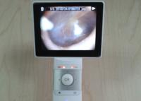 China Neutral White Light Digital Video Otoscope Dermatoscope And Otoscope Camera With High Resolution for sale