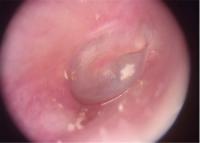 China Disposable Earmuff Available Medical Portable Otoscope Endoscope For Ear Eye Throat for sale