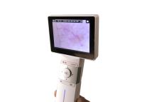 China Professional Digital Video Otoscope for sale