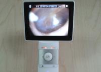 China ProfessionalENT Endoscope Ear Camera Digital Video Otoscope With Rechargeable Lithium Battery for sale