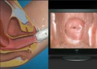 China High Definition Women Self-Examination Endoscope AV ( video ) Signal Digital Electronic Colposcope for sale