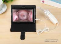 China PAL Color System Vaginal Digital Electronic Colposcope Probe With AAA Batteries for sale