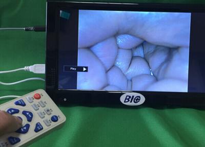 China Video Output Full Digital Electronic Colposcope Gynecology Camera With User Guide for sale