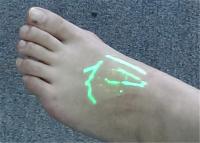 China For Venipuncture Use Infrared Vein Finder Medical Vein Locator to Help Nurse to Find Vessal for sale