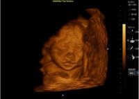 China 256 Level Full Digital 4D Color Doppler Machine With 15 Inch Touch Screen for sale