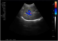 China Panoramic Focusing Color Doppler Machine With 4D Function Optional for sale