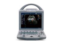 China High Resolution Laptop Color Doppler Machine With 10.4 Inch LCD Monitor Angle Adjustable for sale