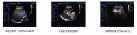 China Portable Color Doppler Machine Ultrasound Scanner For Human Or Animal Use for sale