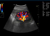 China Full Digital Color Doppler Machine for sale