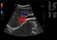 China Full Digital Color Doppler Machine for sale