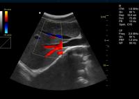 China Full Digital Color Doppler Machine for sale