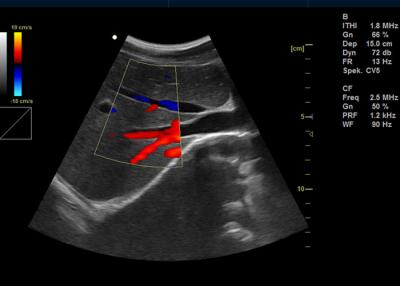 China Professional Color Doppler Machine Ultrasound Scanner Equipment With Software Packages for sale