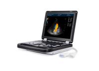 China 2 Probe Connectors Color Doppler Machine System Laptop Ultrasound Scanner With Trolley Optional for sale
