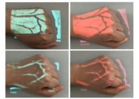 China 2 Color images Vein Locator Device Infrared Vein Finder In Venipuncture For Nurses for sale