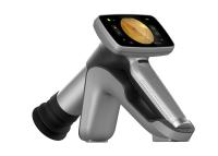 China 3.97 Inch Touch Screen 2.5mm Digital Retinal Camera for sale
