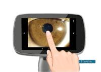 China Handheld Slit Lamp 16G Digital Fundus Camera 80000 Images for sale