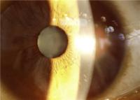 China Handheld Slit Lamp 16G Digital Fundus Camera 80000 Images for sale